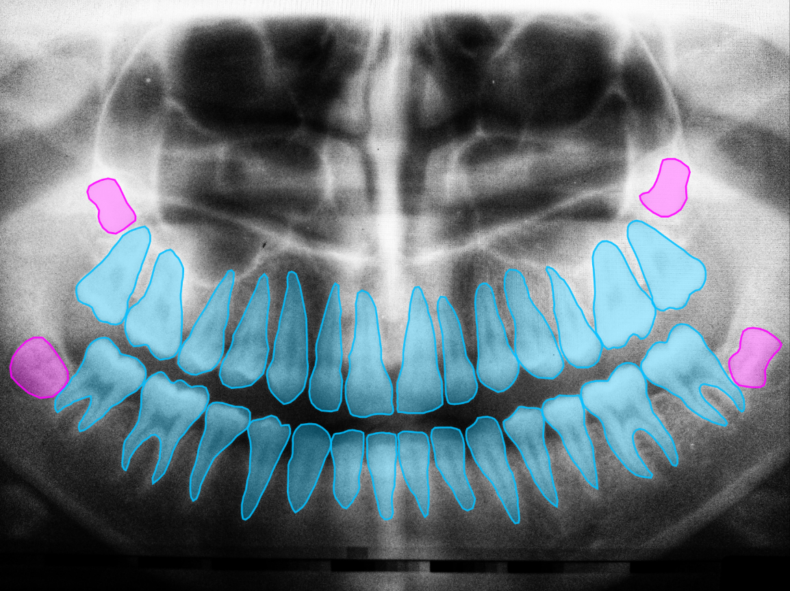 Surgical AI Developers Need the Right Tools | Keylabs