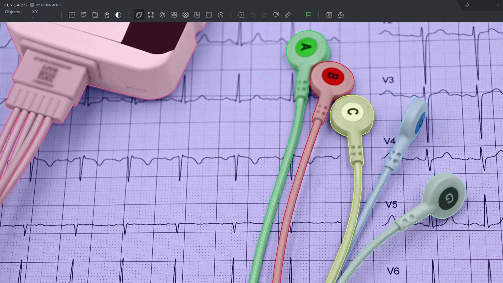 Logistic Regression: Overview and Applications | Keylabs
