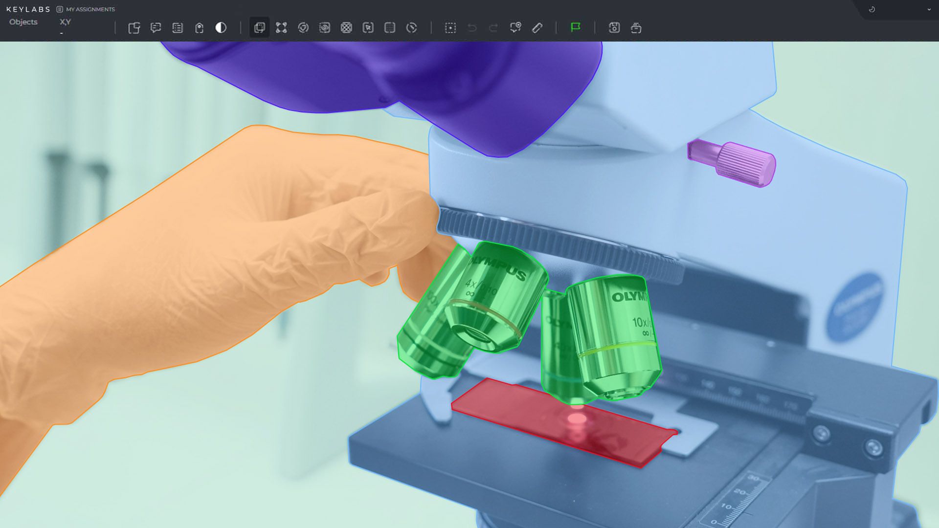 Classification Models in Healthcare:Prediction and Diagnosis | Keylabs