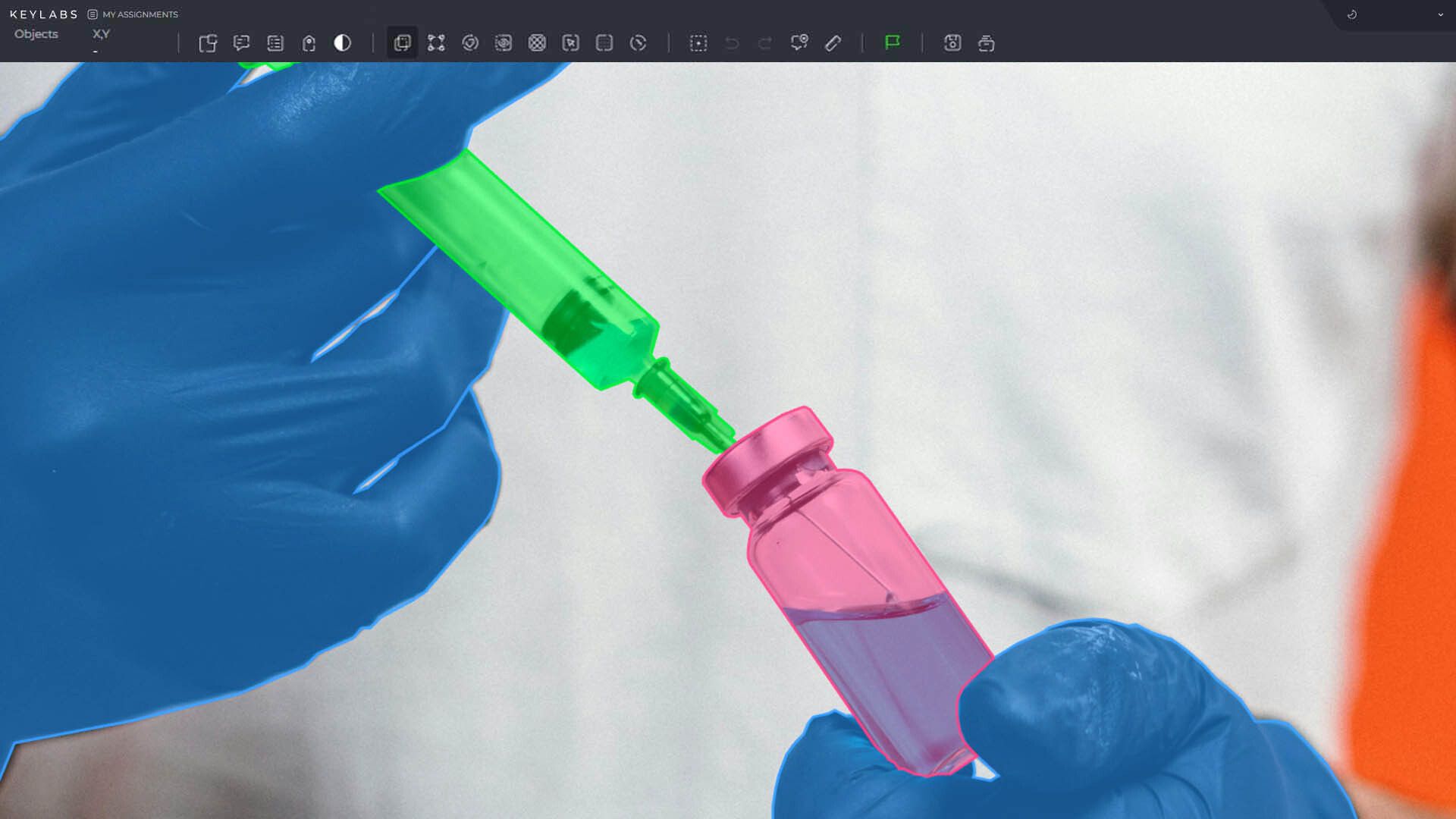 3D Medical Image Segmentation for AI Model Training |Keylabs