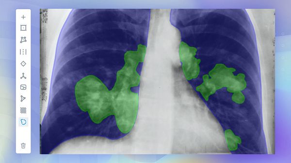 Artificial Intelligence Advancements in Healthcare | Keylabs